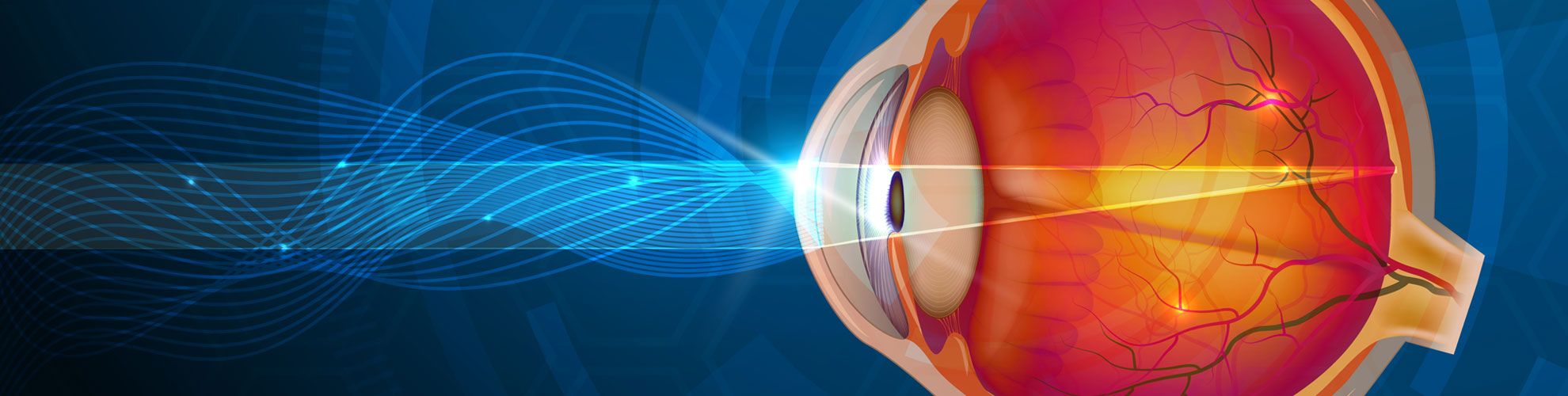 Interactive Eye - Elevation EyeWorks